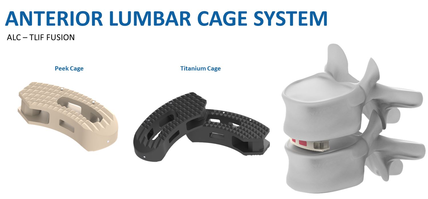 ALC (Anterior Lumbar Cage) Tlif Fusion