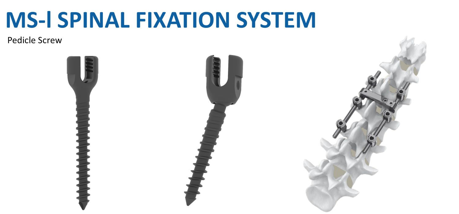 Pedicle Screw (MS-I) Spinal Fixation System