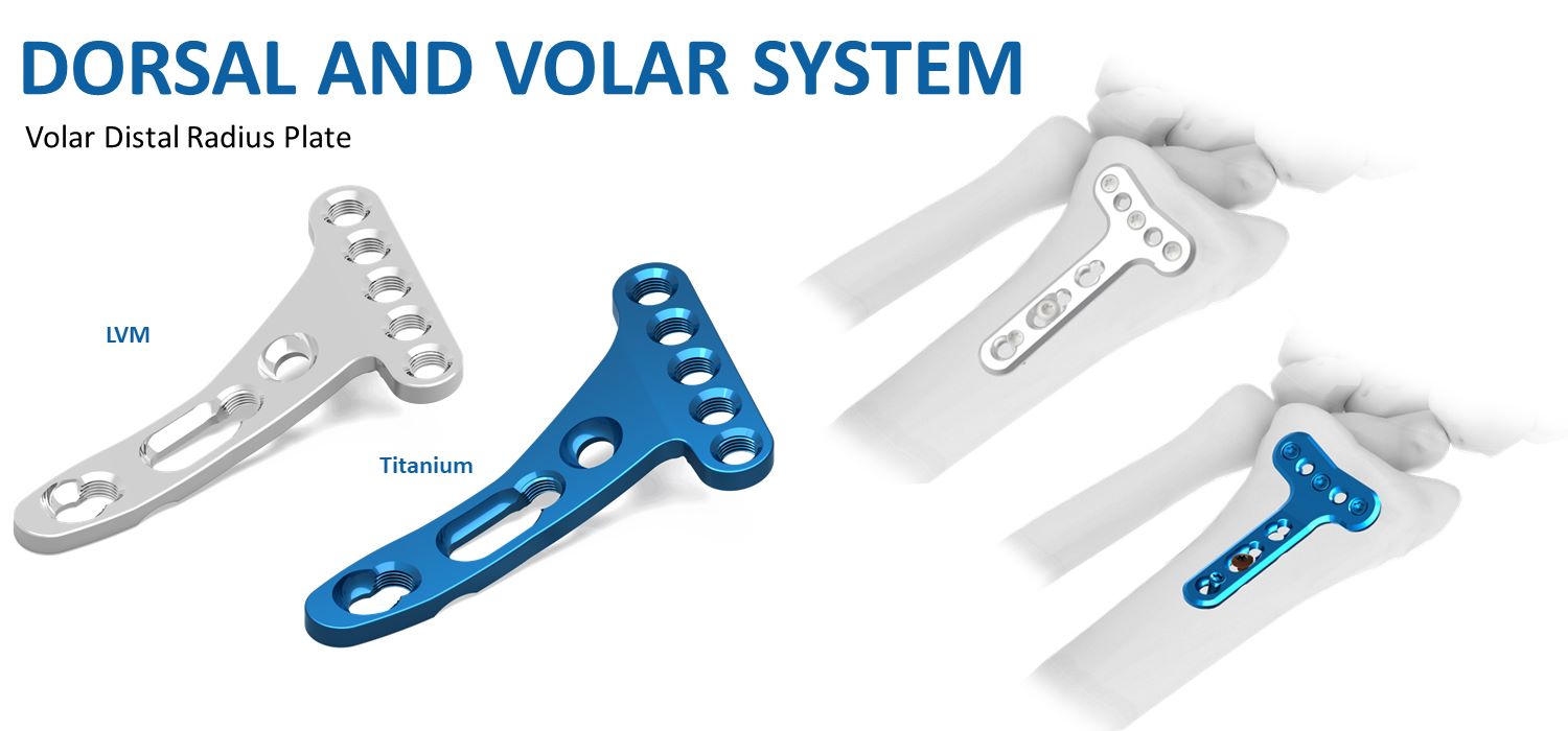 Volar Vs Dorsal Zones Of The Hand (Flexor And Extensor)