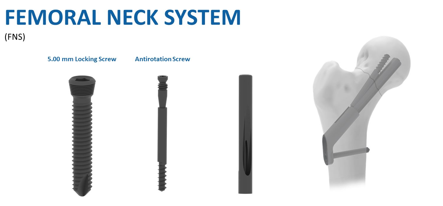 Femur Neck System (FNS)
