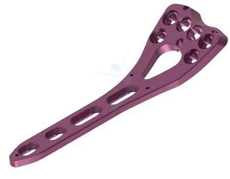 Two Column Volar Plate Distal Radius System (VALP)